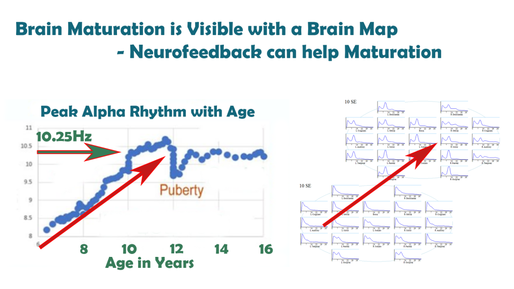 ADD / ADHD - Neurofeedback London