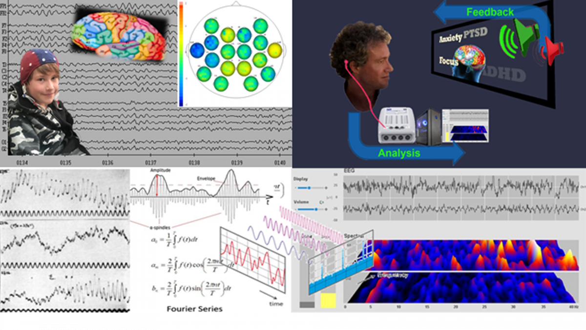 Alpha Theta Neurofeedback Training - Neurofeedback London