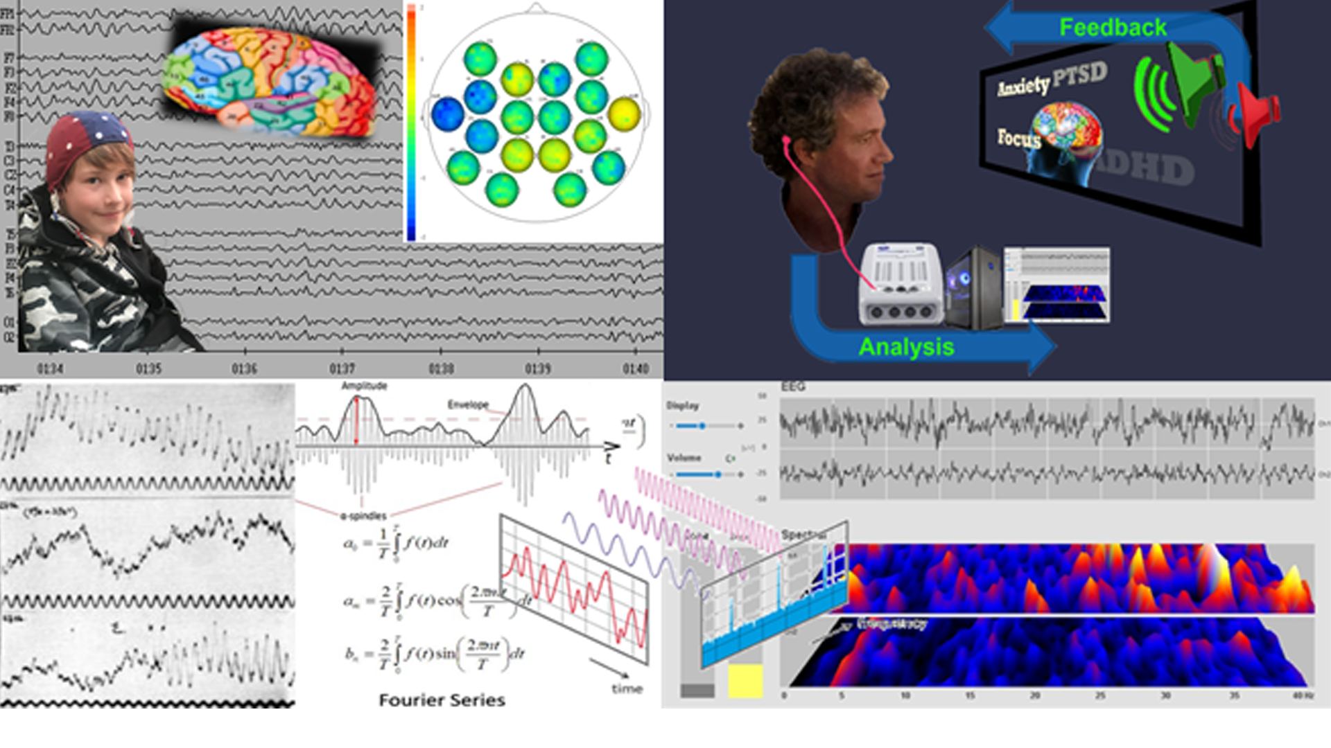 How does it work? - Neurofeedback London