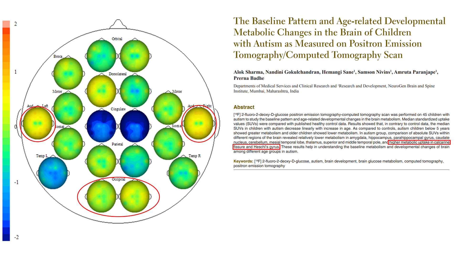 Autism Spectrum and Asperger's - Neurofeedback London