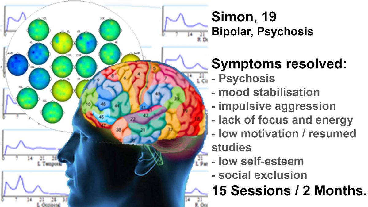 How does it work? - Neurofeedback London
