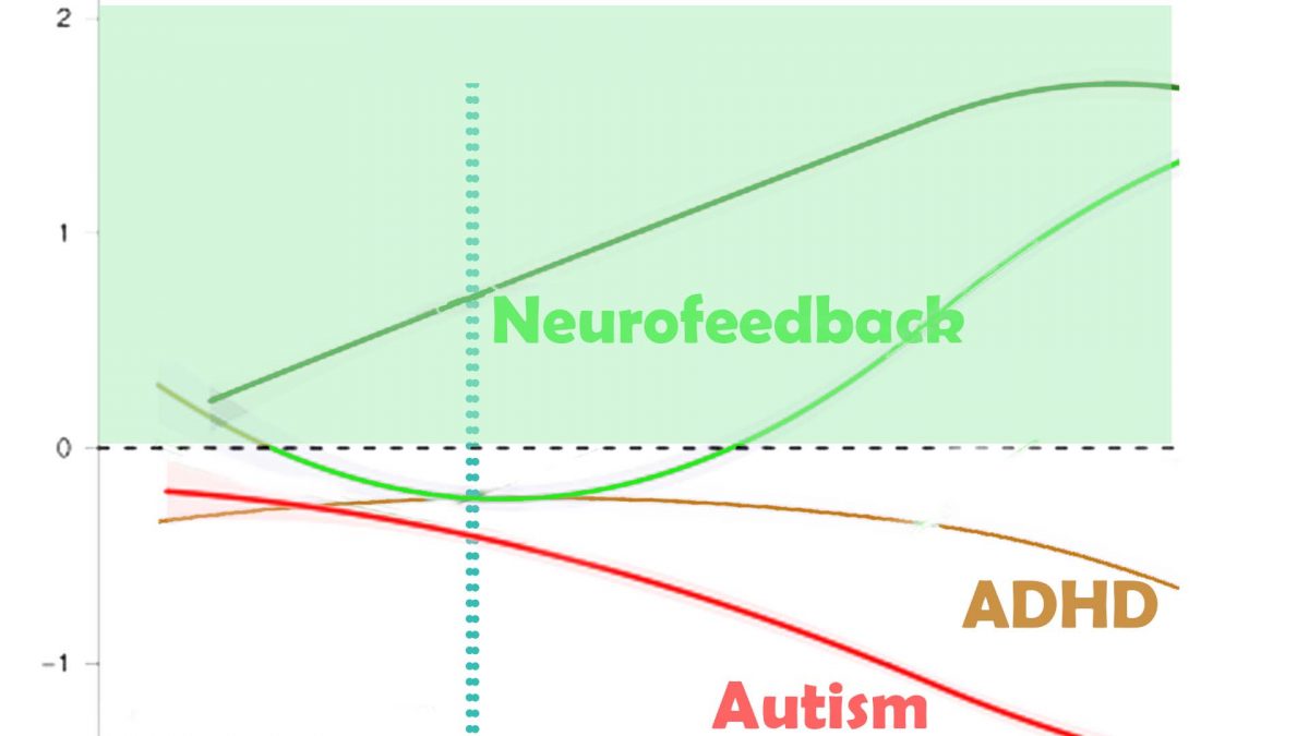 How does it work? - Neurofeedback London